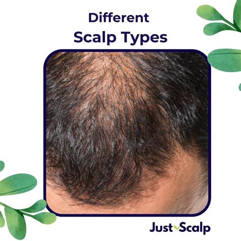 Scalp Type Profiles A Complete How To Guide