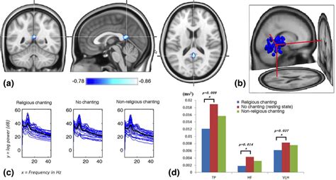 Multi Modal Neuroimaging And Electrophysiological Results Eigenvector