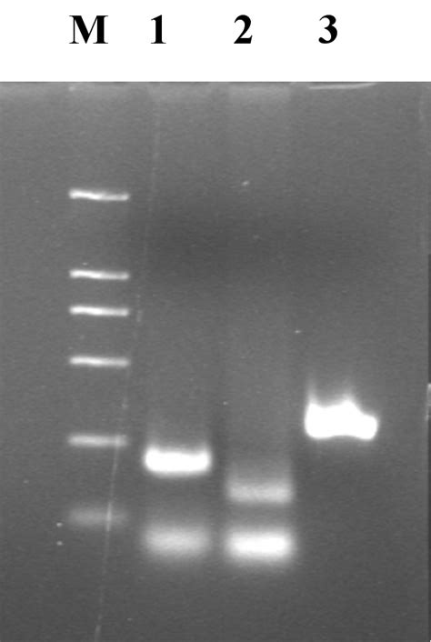 Mboii Restriction Patterns Of The Pcr Amplified Rpsl Gene Lane 1 Pcr Download Scientific