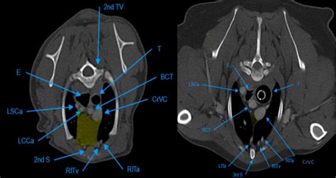 Illustration Of Anatomical And Topographical Location Of Thymus In