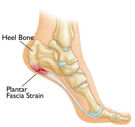 Plantar Fascia Anatomy