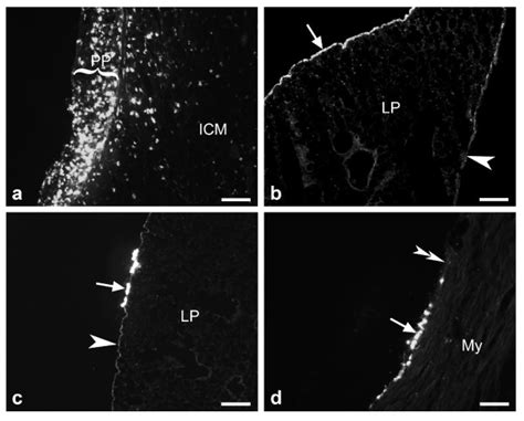 Tracer Dii Distribution In Thoracic Tissues 6 Days After Application