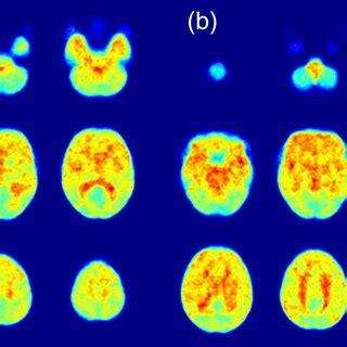 The BOLD Delay Testretest Differences In Seconds Mean Across Download Scientific Diagram