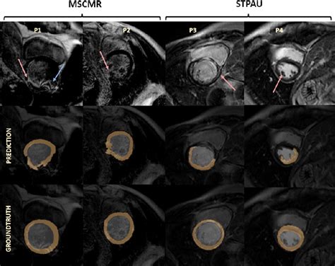 Figure 1 From Domain Generalization In Deep Learning For Contrast Enhanced Imaging Semantic