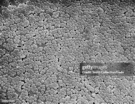 Enterococcus Photos And Premium High Res Pictures Getty Images