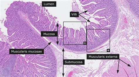 Layers Of Small Bowel Histology