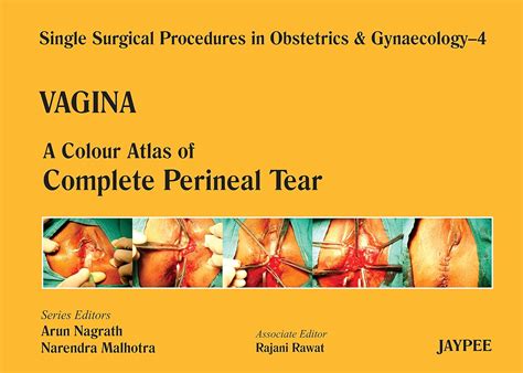 Single Surgical Procedures In Obstetrics And Gynaecology 04 Vagina A