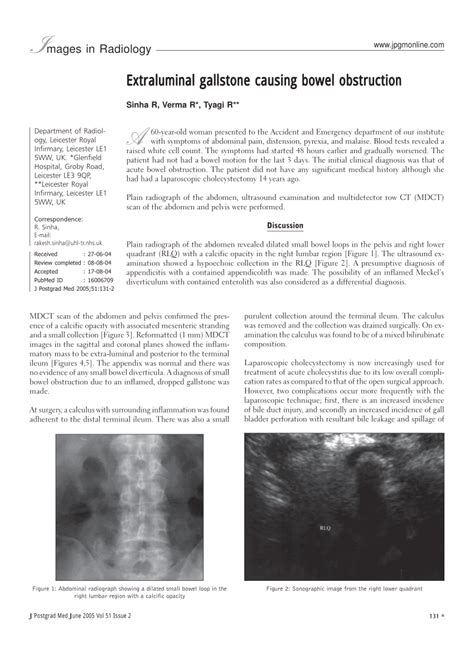 Pdf Images In Radiology Extraluminal Gallstone Causing Bowel Obstruction
