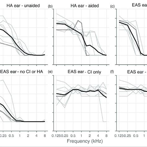 Rationale On How Hearing Asymmetry In Bimodal Eas Users Influences