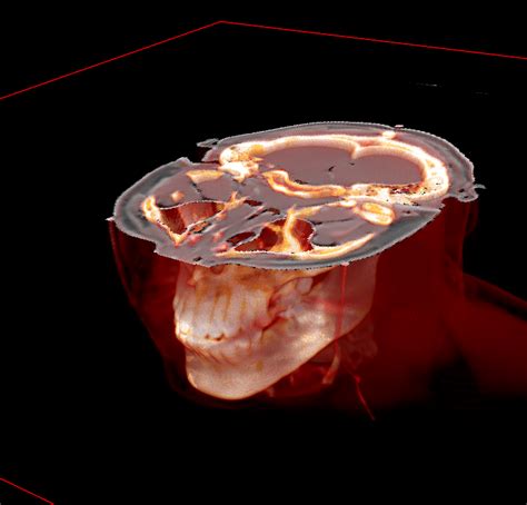C How To Get The Position Of 2d Dicom Image Slice In 3d Surface