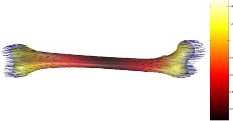 Figure 4 From Statistical Bone Shape Analysis For Image Free Surgery Semantic Scholar