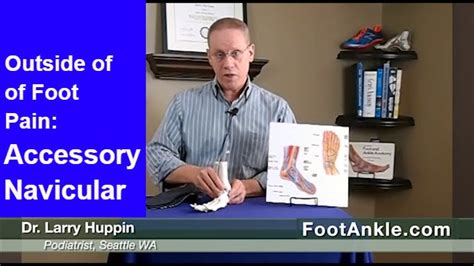 Accessory Navicular Surgery See Stunning Before And After Results