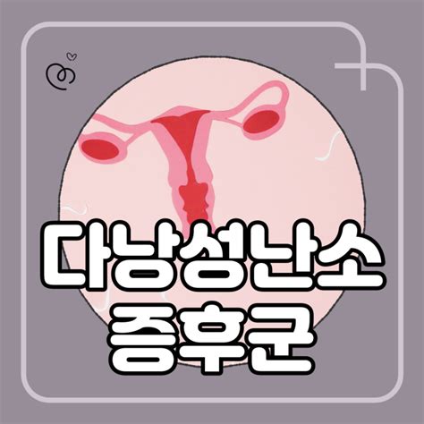 다낭성 난소 증후군 증상 임신 원인 검사 자궁질환 치료 방법 네이버 블로그