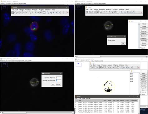 Quantification Of The Distribution Of Vesicles In Different Sections Of