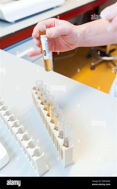 Urology Laboratory Urine Samples Being Prepared For Analysis In Tubes In A Laboratory Typical