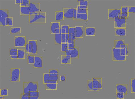 Fully Supervised A Vs Weakly Supervised B Example The Fully Download Scientific Diagram