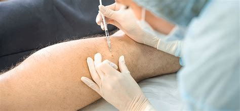 Trigger Point Injections Fort Worth Top Rated Trigger Point Injections