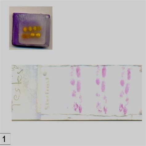 Tma Tissue Microarray Block And Slide Download Scientific Diagram