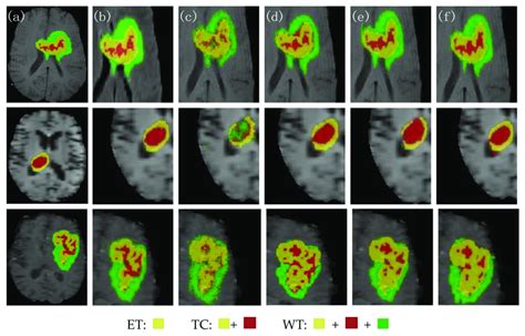comparison of the segmentation effects of the different network models