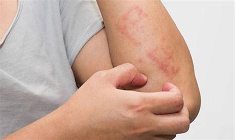 Top 9 Best Methods To Get Rid Of Scratch Marks