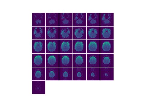 Mosaic Plot — Pycortex 1 2 11 Documentation