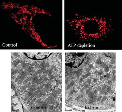 Mitochondrial Cytopathies And Cardiovascular Disease Heart