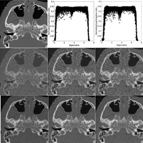 a medical image denoising method based on principles of quantum