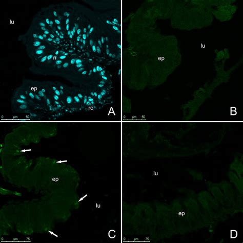 Detection Of Cell Death Dna Fragmentation By The Tunel Reaction In Download Scientific