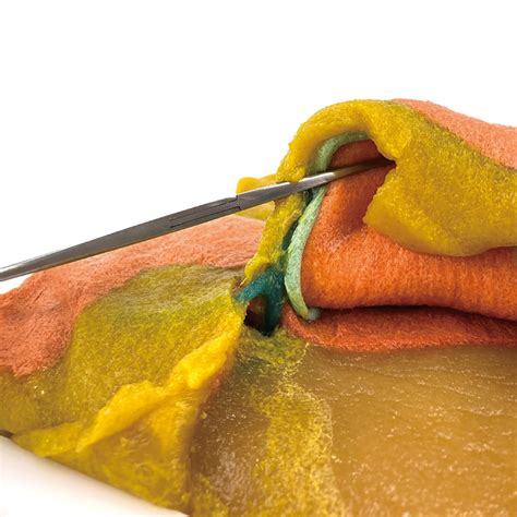 Vtt Laparoscopic Distal Gastrectomy Model【vtt Ldg】 Kotobuki Medical