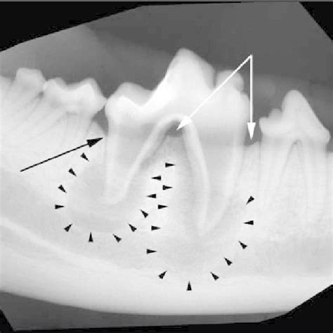 Same Radiographic View As In Figure 2a Notice The Large Radiolucencies Download Scientific