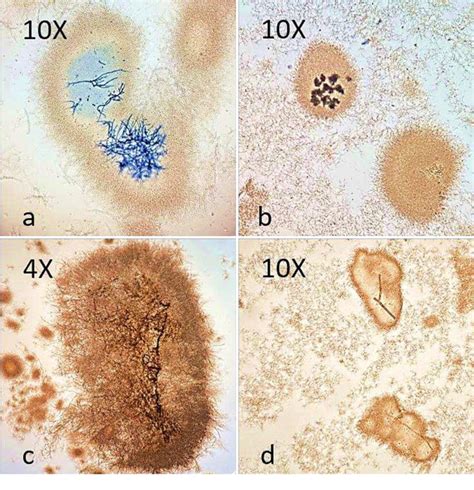Light Microscopy Photomicrographs Of Actinomycetes Smears A Mycelium Download Scientific