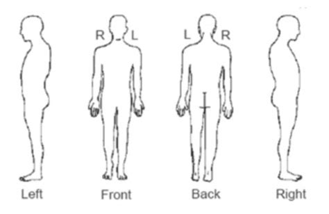 Wheelchair Assessment Physical Assessment Physiopedia