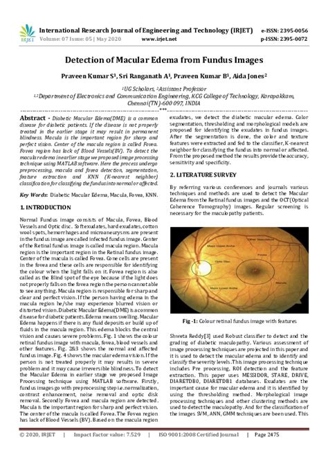 Pdf Irjet Detection Of Macular Edema From Fundus Images