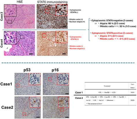 The Significance Of Cytoplasmic Stat6 Positivity And High P53 P16 Expression As A Novel