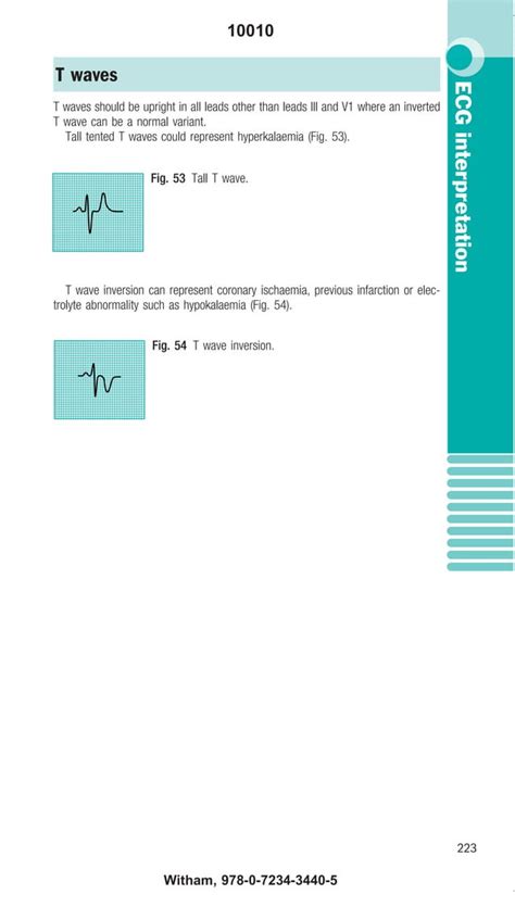 Ecg Interpretation Pdf