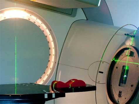 Fewer Larger Radiotherapy Doses Prove Effective For Prostate Cancer