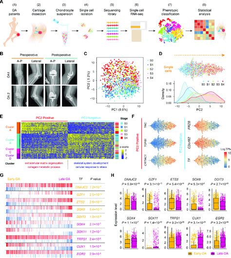 Single Cell Rna Seq Of Human Oa Cartilage Chondrocytes A Schematic