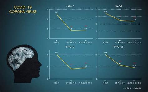 와이브레인 ‘우울증 전자약 코로나19 브레인포그 개선 효과