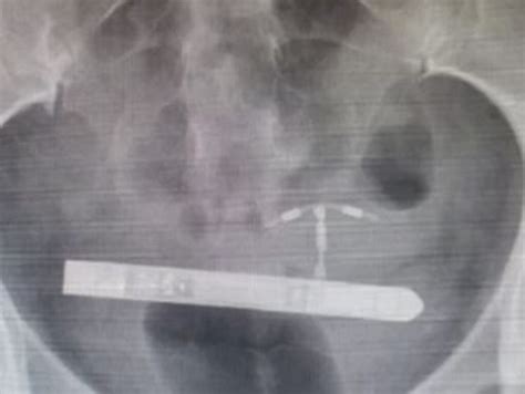 Sex Expert Advice For Sexual Health Wellbeing News Com Au Australias Leading News Site