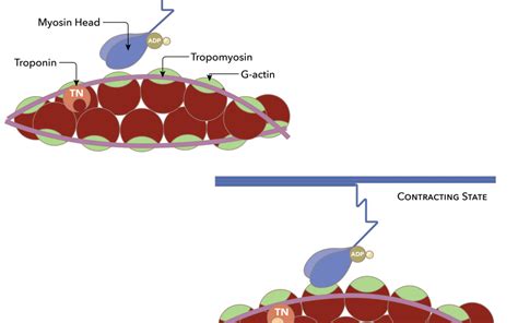 Rapid Acute Coronary Syndrome Evaluation Over One Hour With High