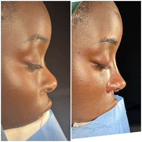 Opdrhüseyin Karabulut She Came From Usa 🇺🇸 More Defined More