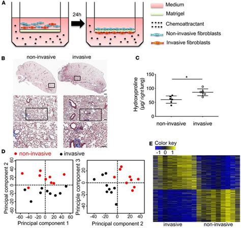 Jci Insight Pd L1 On Invasive Fibroblasts Drives Fibrosis In A Humanized Model Of Idiopathic