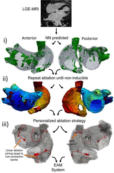 Po 01 204 An Artificial Intelligence Ai Assisted End To End