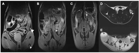 Figure 1 From High Resolution Mri For Non Invasive Mouse Lymph Node