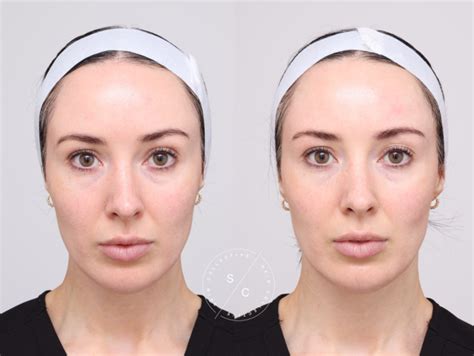 Perth Clinic Banks On This Celebrity Approved Microcurrent Technology