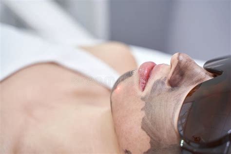Female Undergoing Laser Skin Treatment In Cosmetic Clinic With