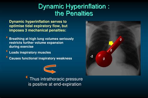 Ppt Exercise Training Effects On Dyspnea And Dynamic Hyperinflation Powerpoint Presentation