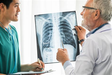 수석 남성 의사 병원에서 다른 의사와 작업 하는 동안 환자 흉부 부상의 엑스레이 필름을 보고 있습니다 의료 의료 직원과 의사 서비스 의사에 대한 스톡 사진 및 기타 이미지