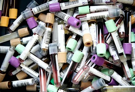 Hemoconcentration Causes Symptoms Treatment