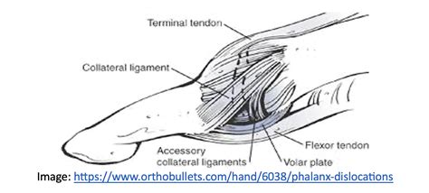 Em 3am Phalanx Dislocation Emdocs